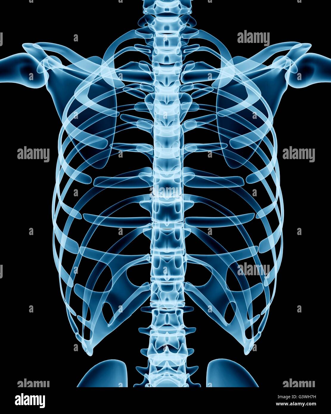 x-ray image of a man isolated on black Stock Photo - Alamy