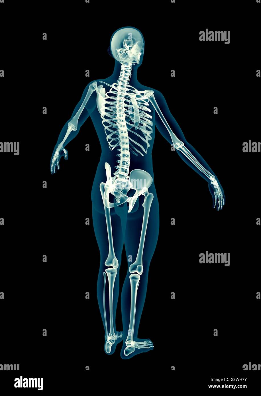 x-ray image of a man isolated on black Stock Photo - Alamy