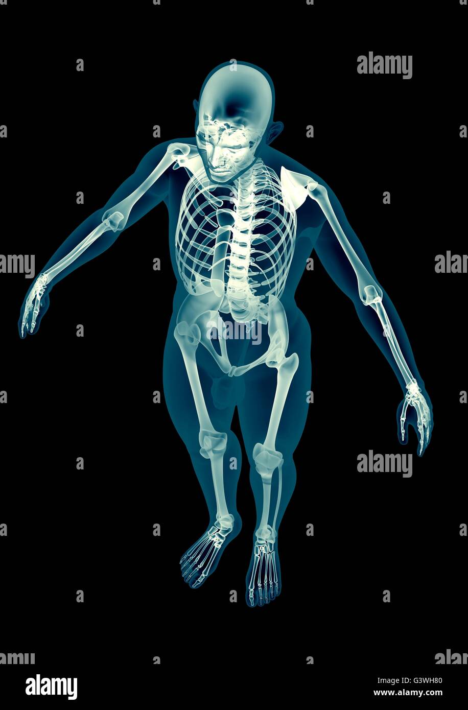 Man Full Body X Ray
