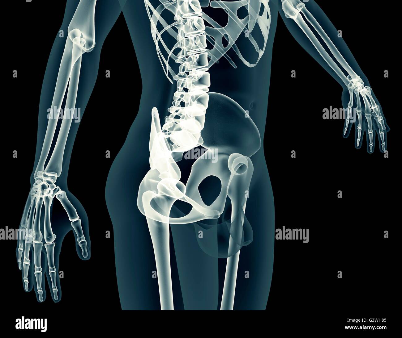 x-ray image of a man isolated on black Stock Photo - Alamy