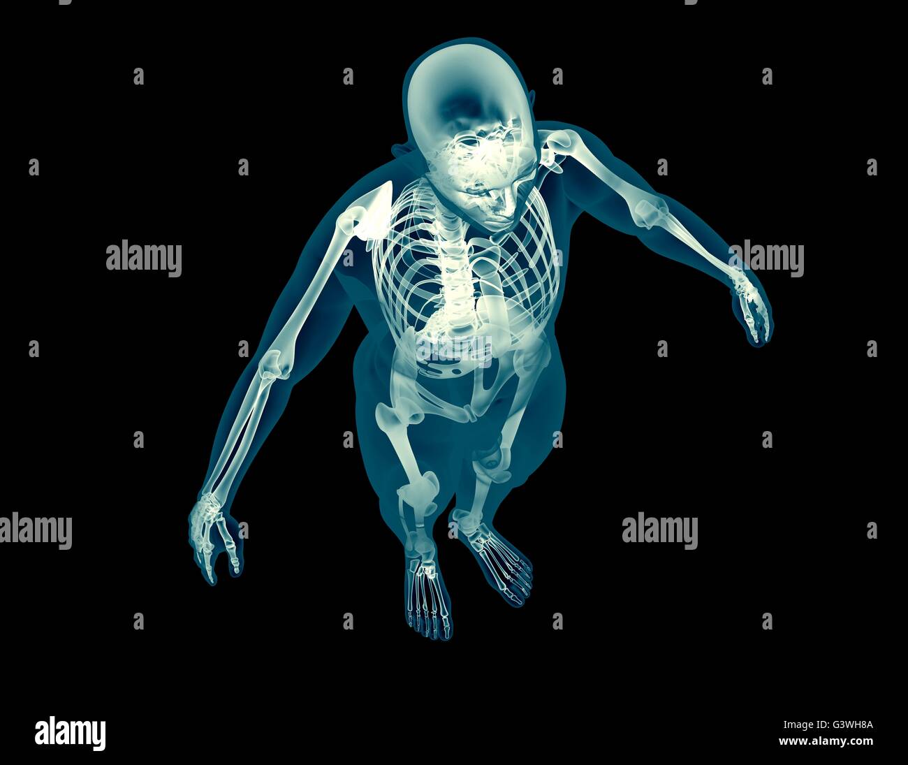 x-ray image of a human body Stock Photo - Alamy