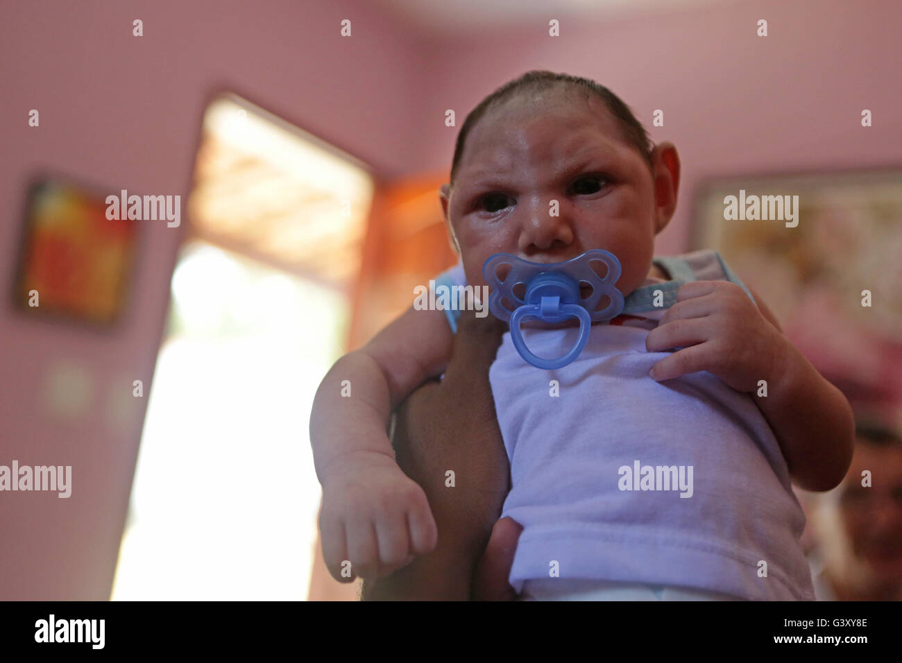 Small Head Big Body Disease