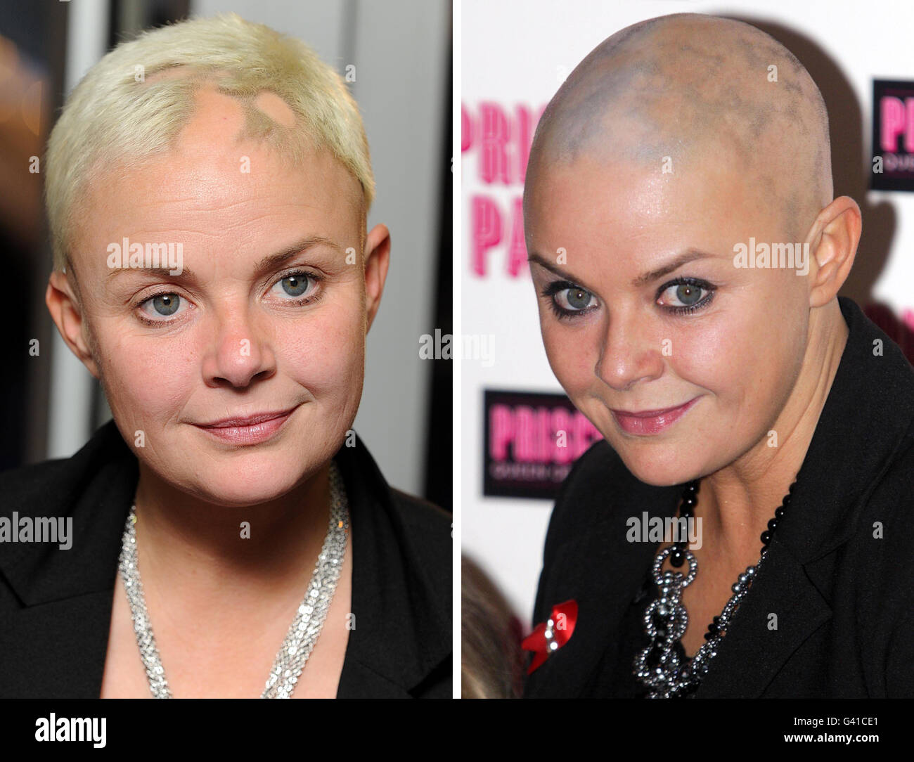 File photos dated 24/3/2010 (left) and 24/1/2011 of Gail Porter who has ...