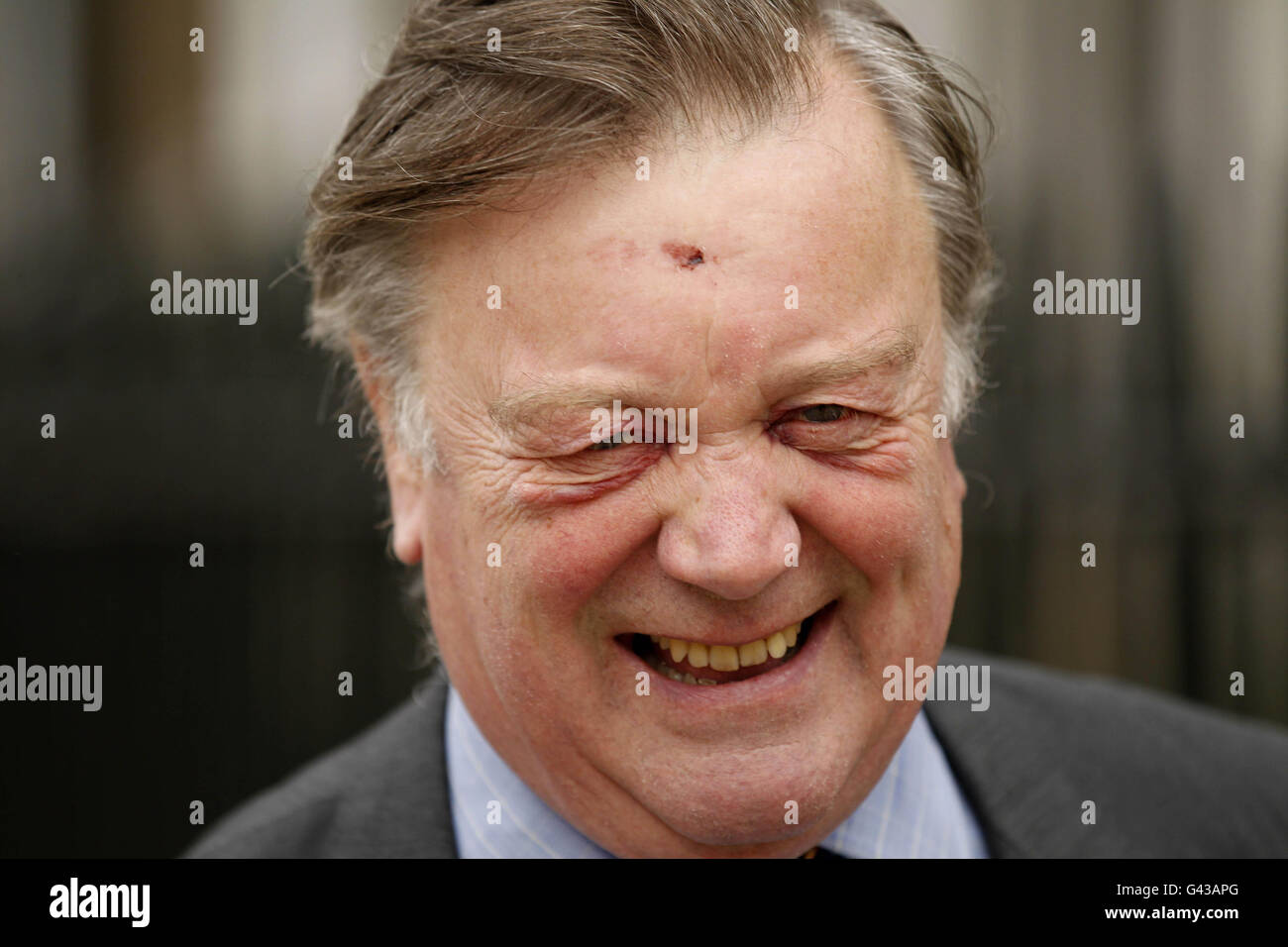 Kenneth Clarke's injuries Stock Photo - Alamy