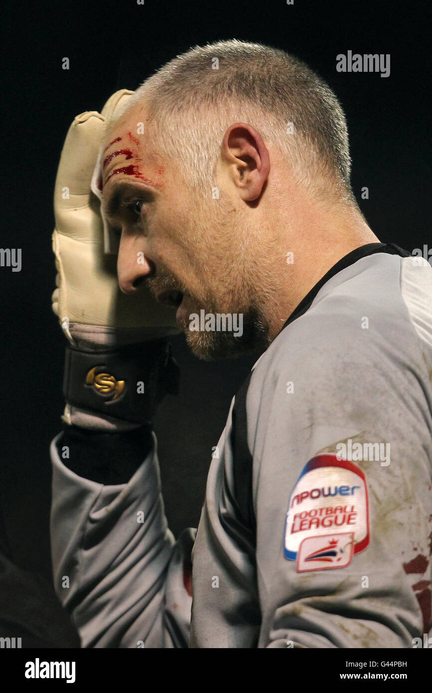 Soccer football blood bleeding hi-res stock photography and images - Alamy