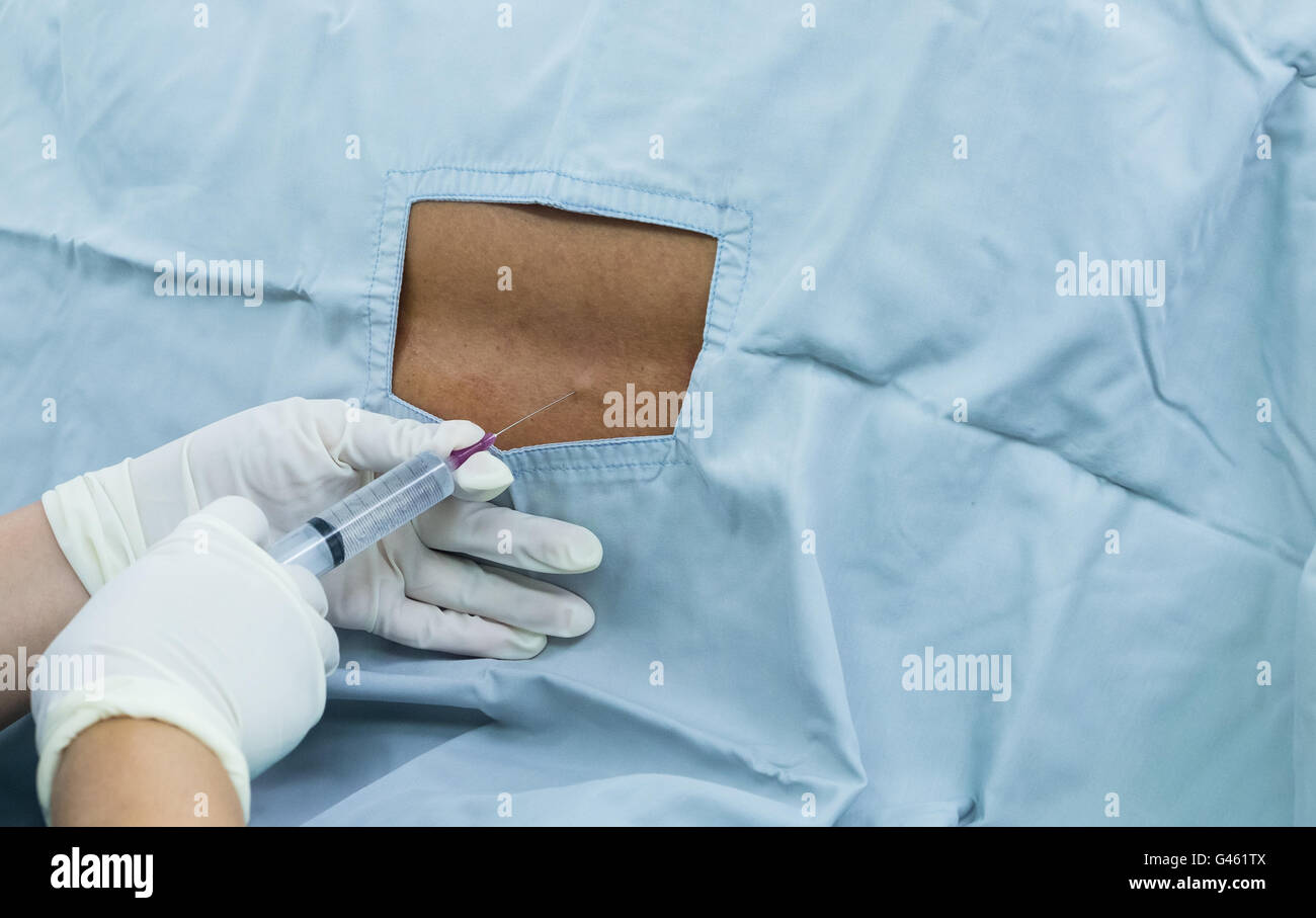 spinal nerve block Stock Photo - Alamy
