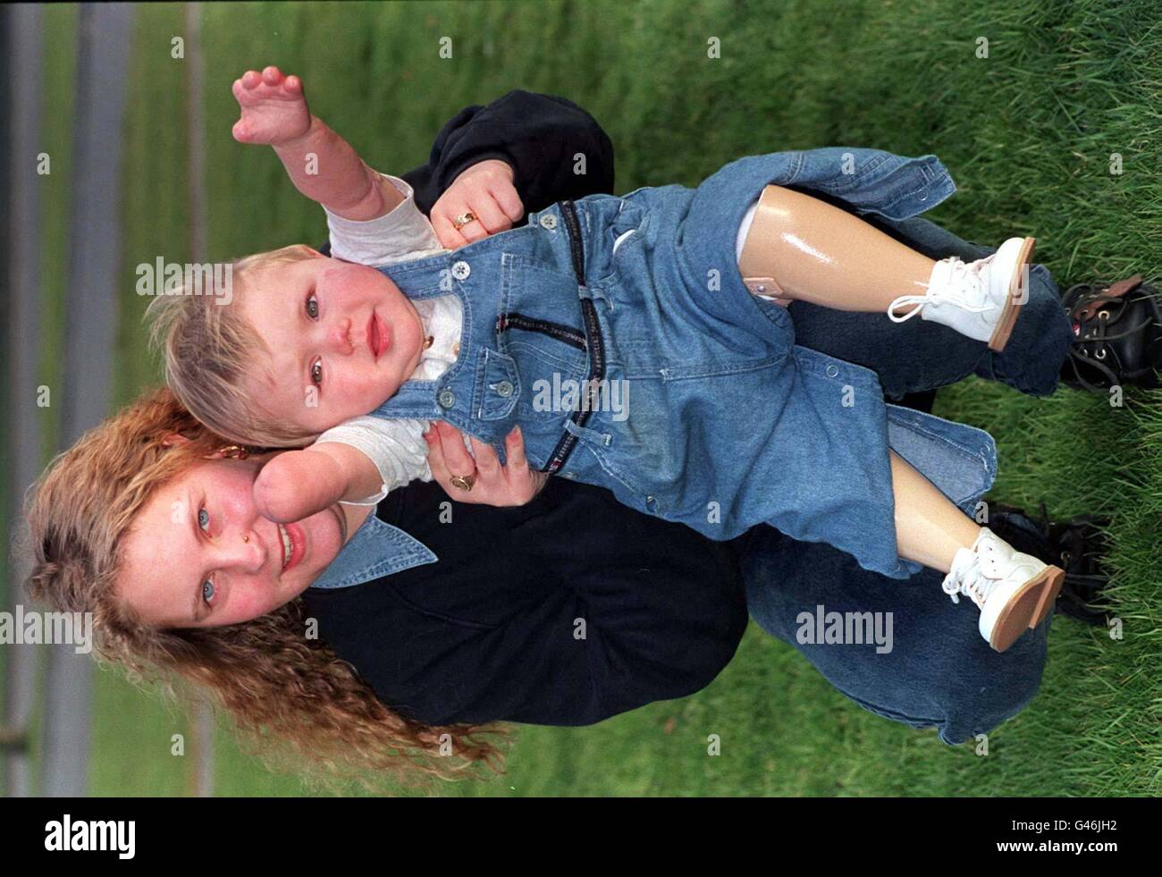 Artificial leg toddler 2 Stock Photo - Alamy