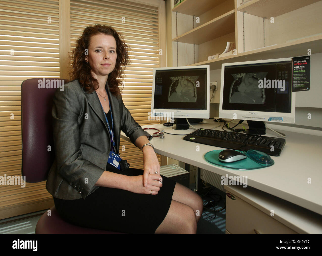 Cystic fibrosis lung hi-res stock photography and images - Alamy