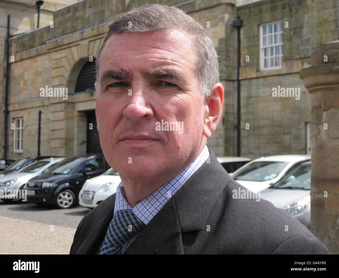 Whose nose was bitten off by a great dane hi-res stock photography and ...