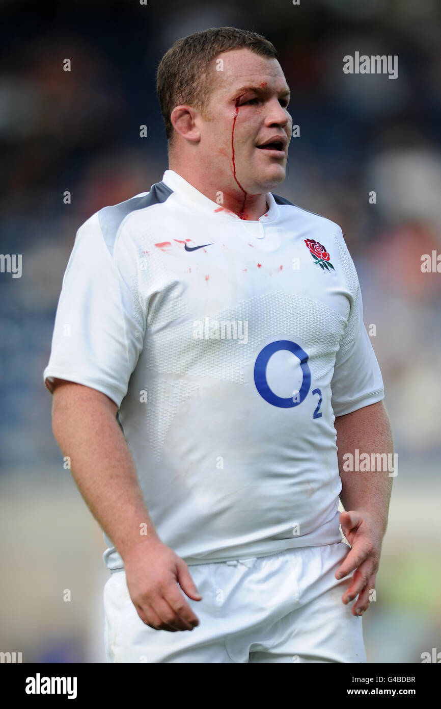 Eye cut bleeding blood head shot headshot portrait ampics hi-res stock ...