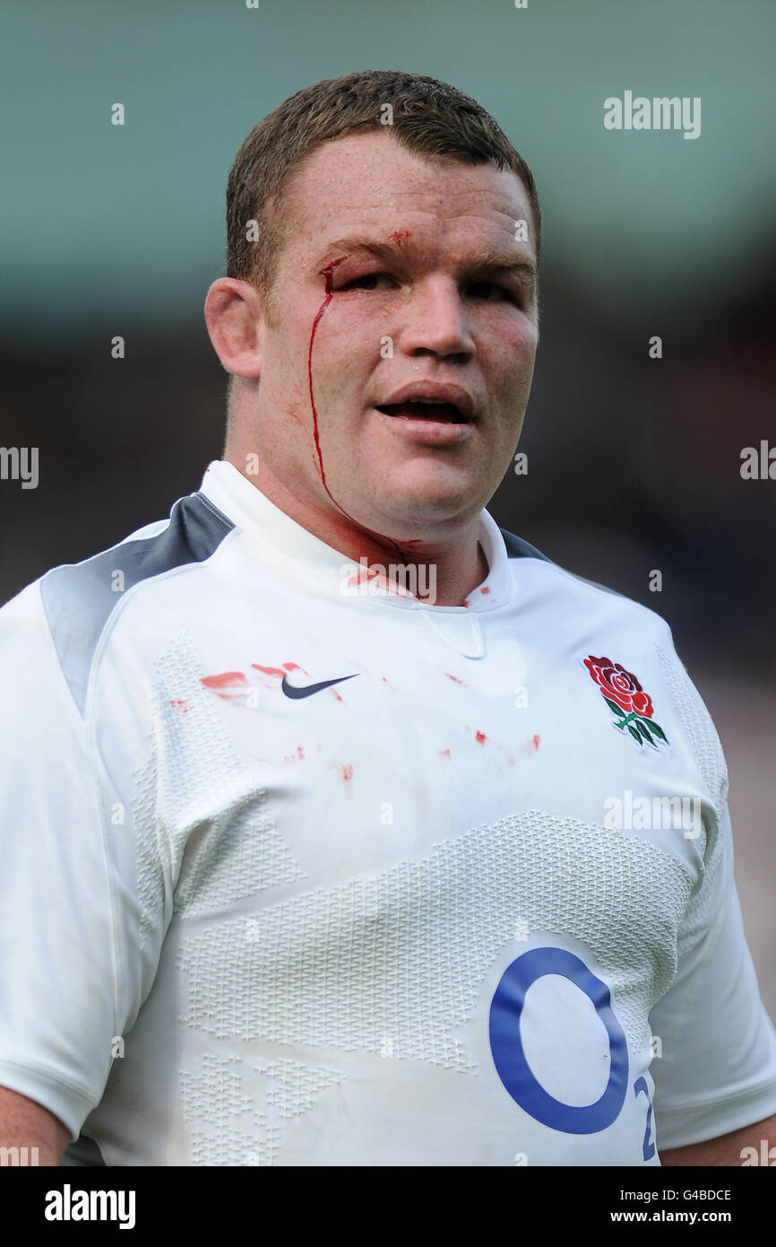 Eye cut bleeding blood head shot headshot portrait ampics hi-res stock ...