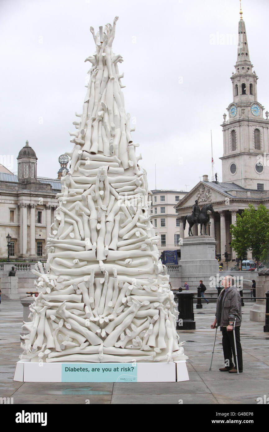 Lionel Larkman, who lost a limb to Type 1 diabetes, looks at a 20 foot ...