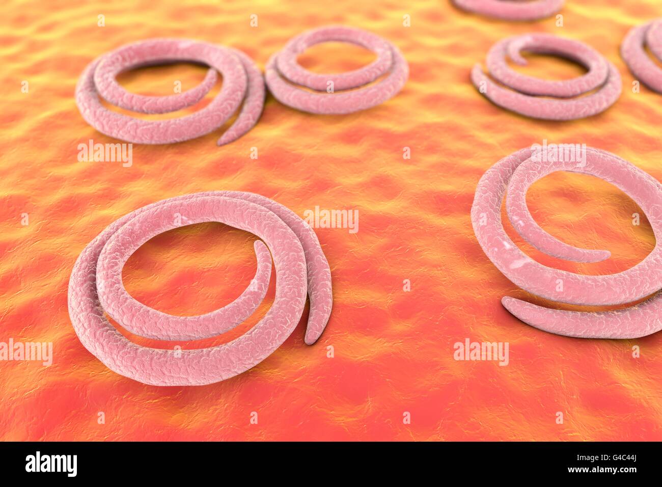 Trichina spiralis roundworm (formerly called Trichinella spiralis ...