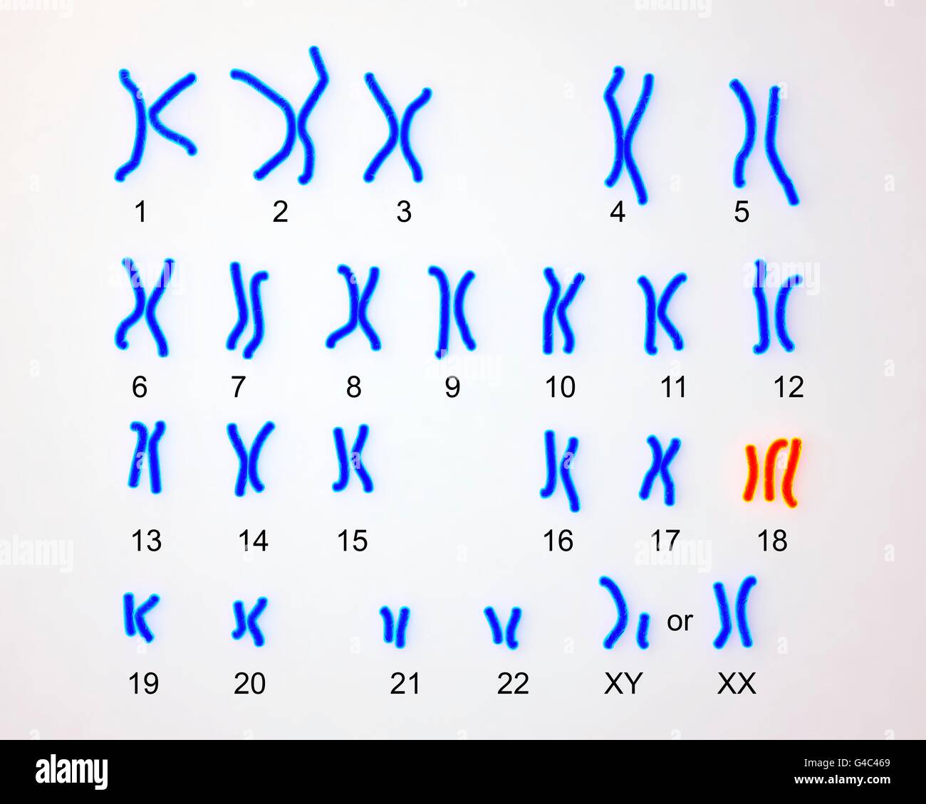 Karyotype showing the arrangement of chromosomes in a male or female ...
