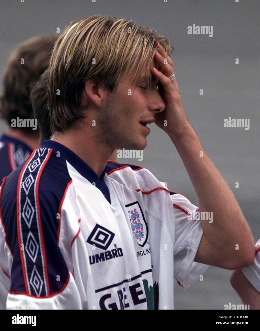 England's David Beckham puts his hand to his head during a break from ...