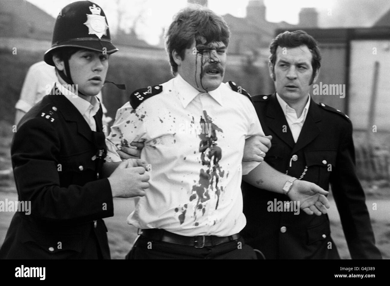 A police officer, blood streaming from a head wound, being helped away ...