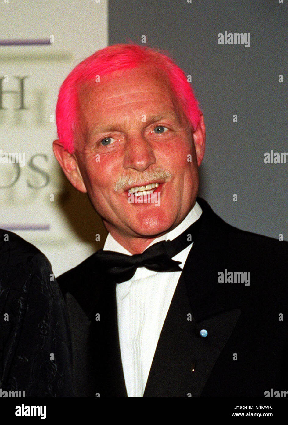 Pollard head hi-res stock photography and images - Alamy