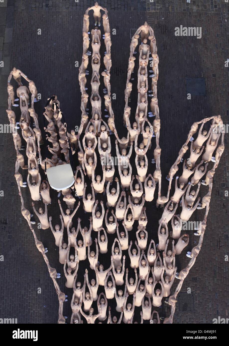 Dupuytrens contracture hi-res stock photography and images - Alamy