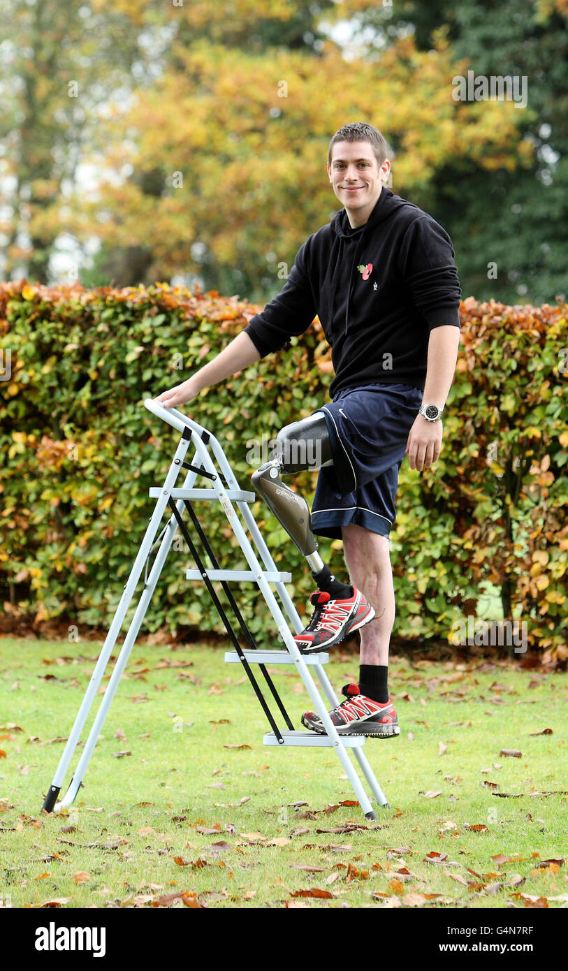 Became first uk patient fitted new bionic leg prosthetic system hi-res ...