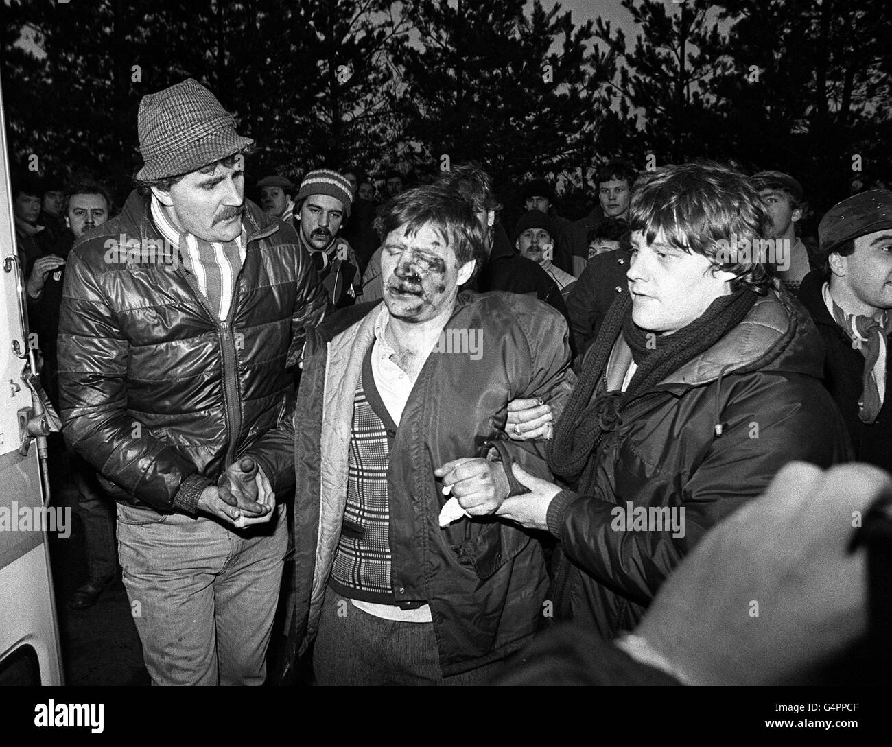 An injured NUM picket is led away by colleagues from the pickit line at ...