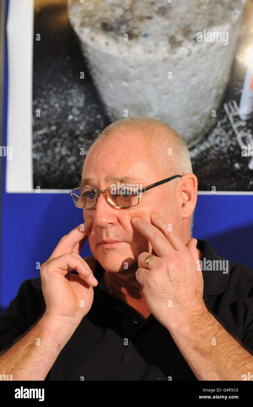 Steve Manley, describes injuries sustained to his wife at a press ...