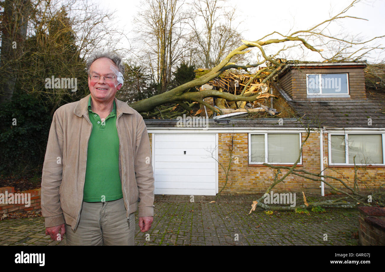 Richard Wilkinson, 65, outside his home in Winchester, Hampshire, after ...