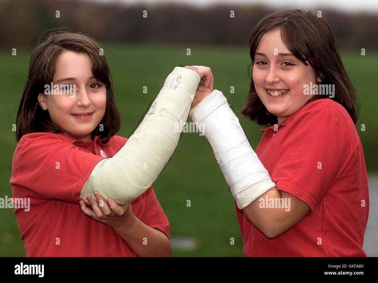 Twin/broken wrist 1 Stock Photo - Alamy