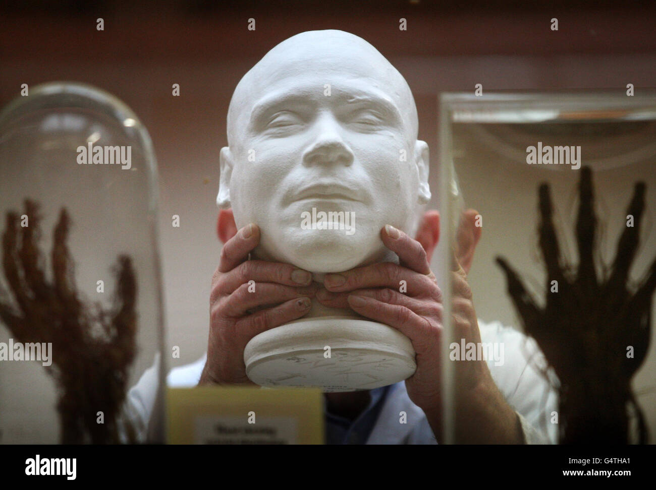 William burke skeleton hi-res stock photography and images - Alamy