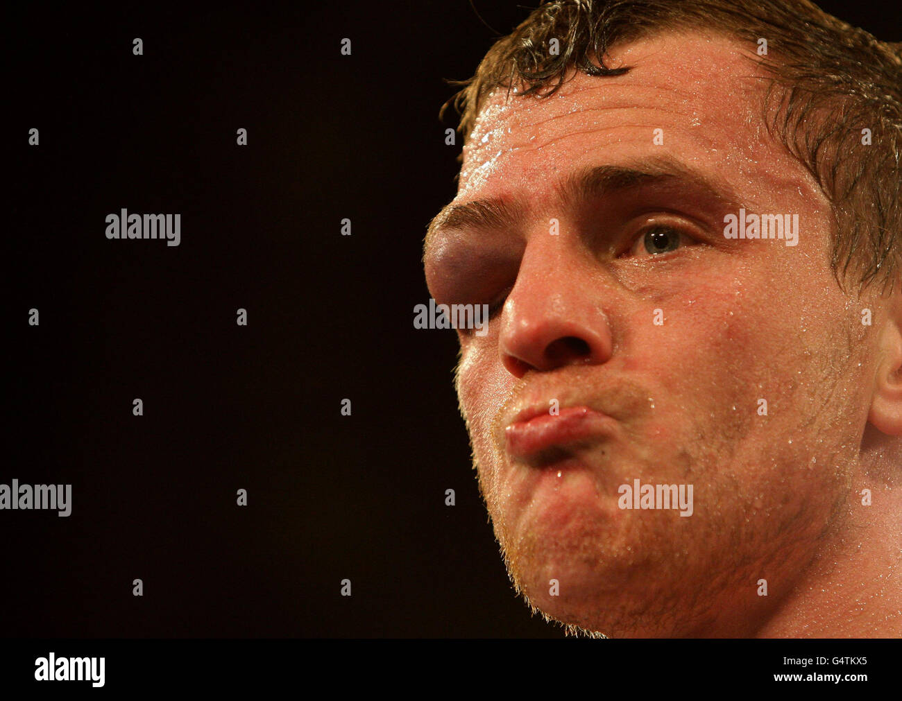 Ryan Toms after the referee decided he was in no state to continue ...