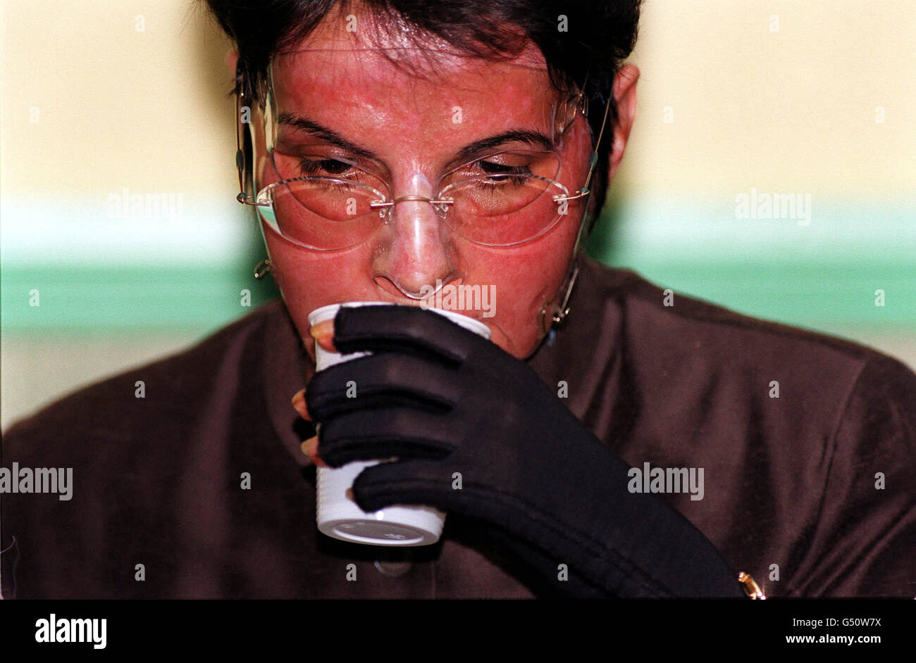 Pam Warren, 33, from Berkshire who was severely burnt in the Ladbroke ...