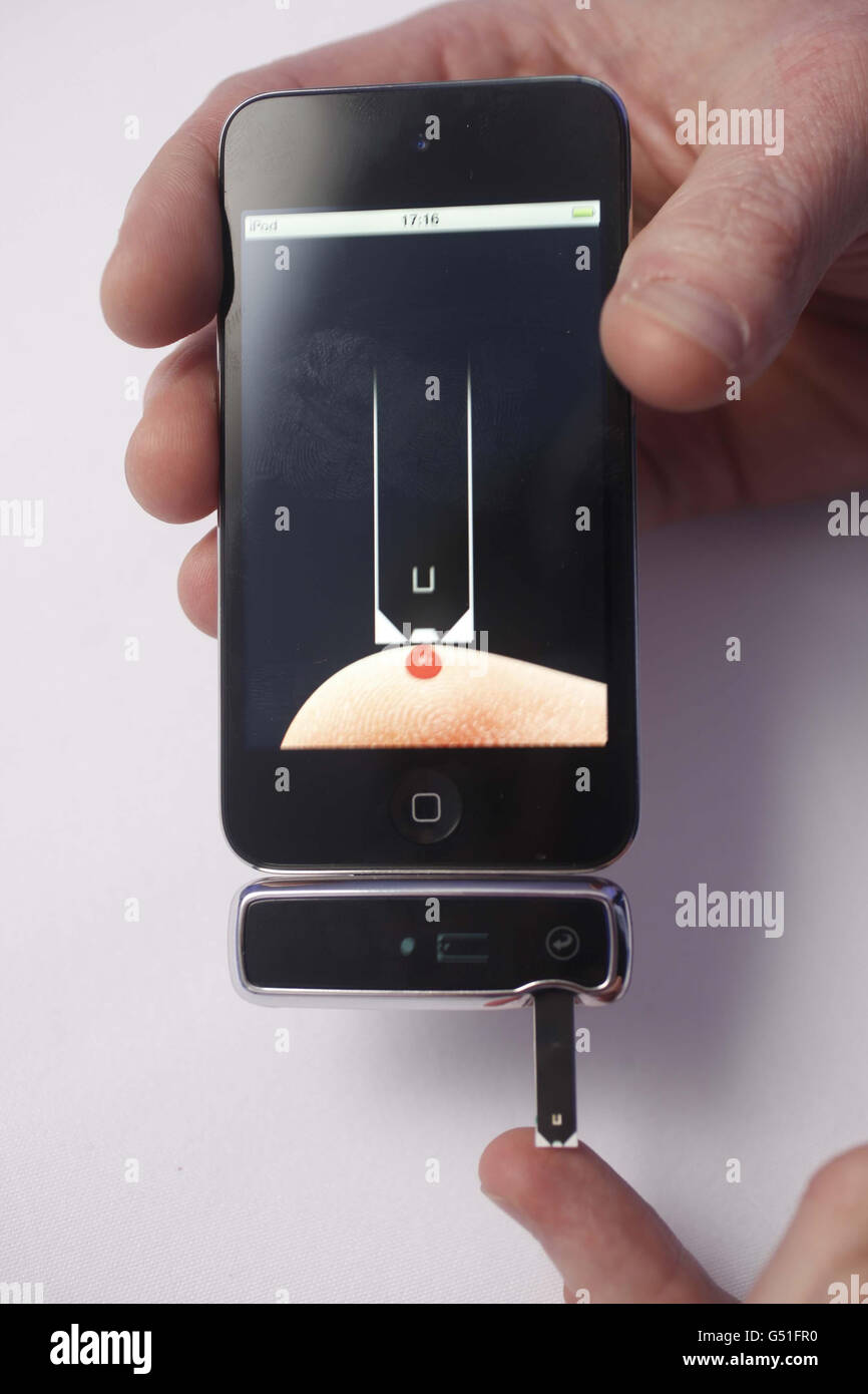 The Sanofi iBGStar blood glucose monitor (BGM), which connects directly ...