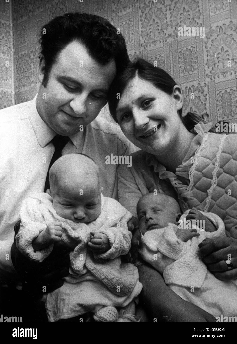 Barbara (left) and Anna Rozycki, the Siamese twins separated by ...