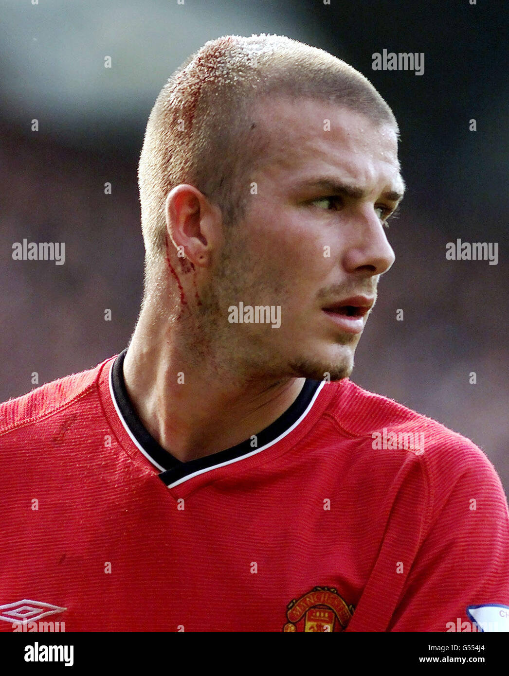 Manchester United's David Beckham, blood stained after a challenge with ...