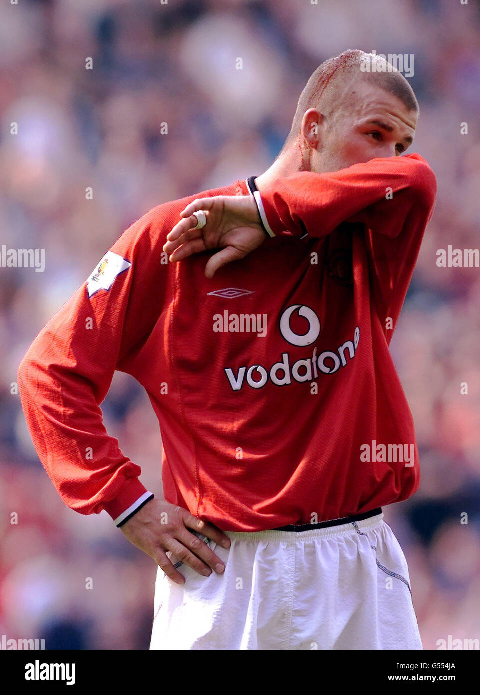 Manchester United's David Beckham, blood stained after a challenge with ...