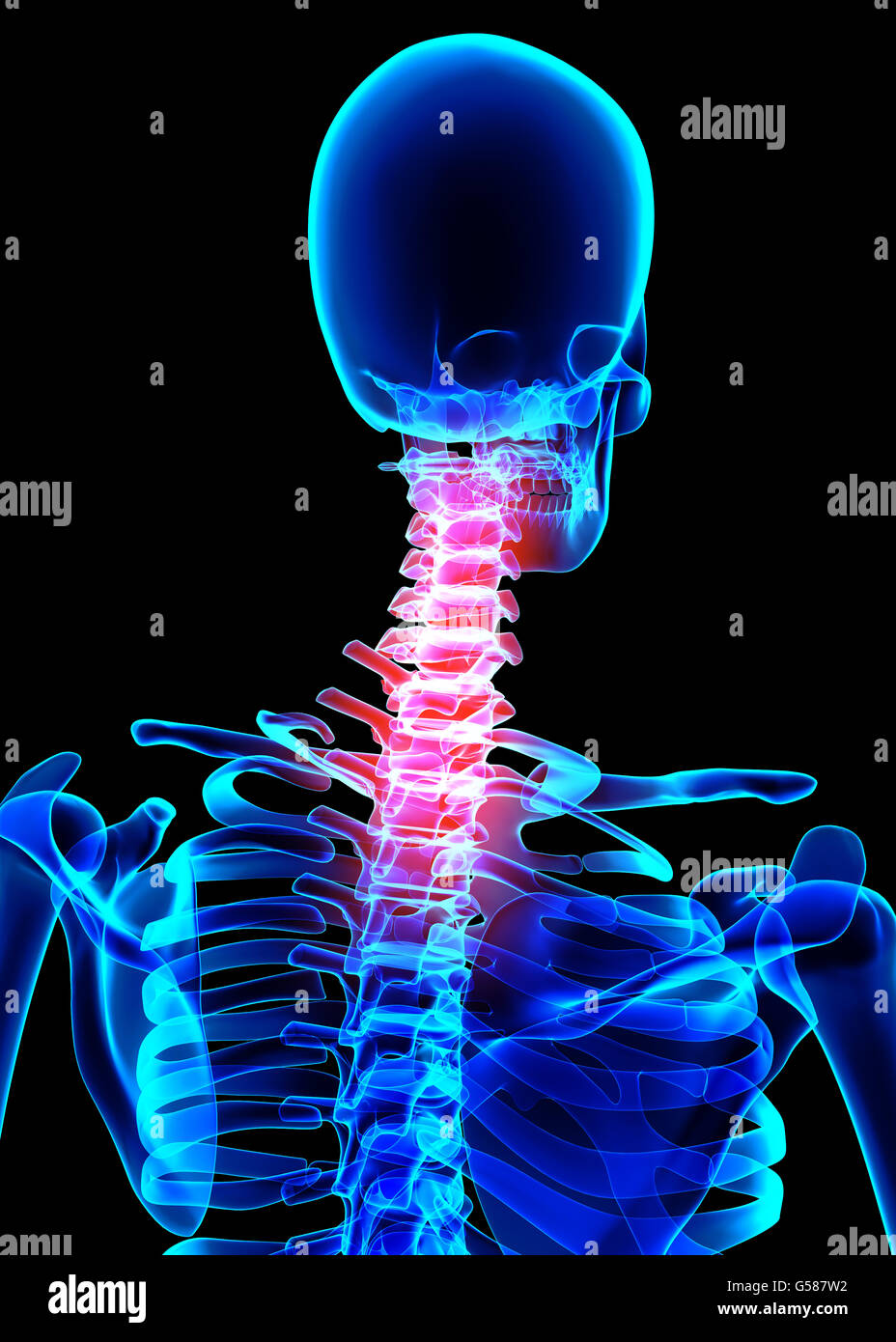 Illustration and neck hi-res stock photography and images - Alamy