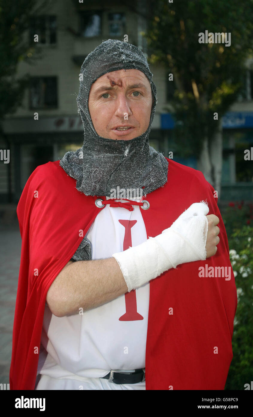 Stan Stansfield with a dislocated thumb, broken wrist and cut forehead ...