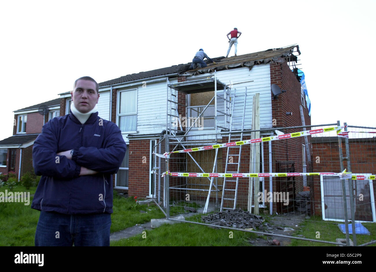 Lightning injuries hi-res stock photography and images - Alamy