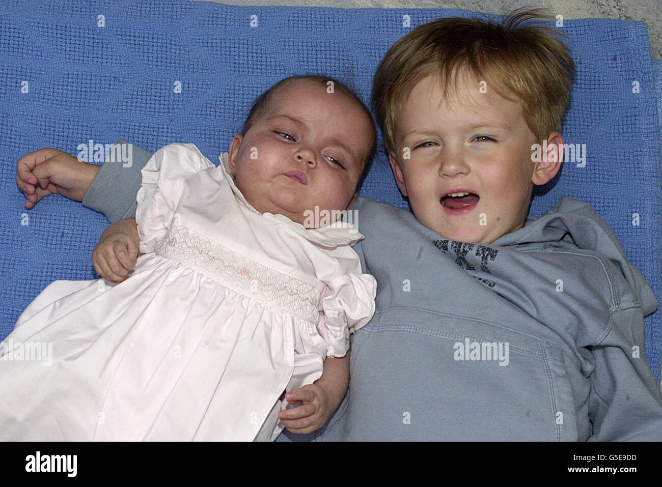 Who underwent a liver transplant hi-res stock photography and images ...