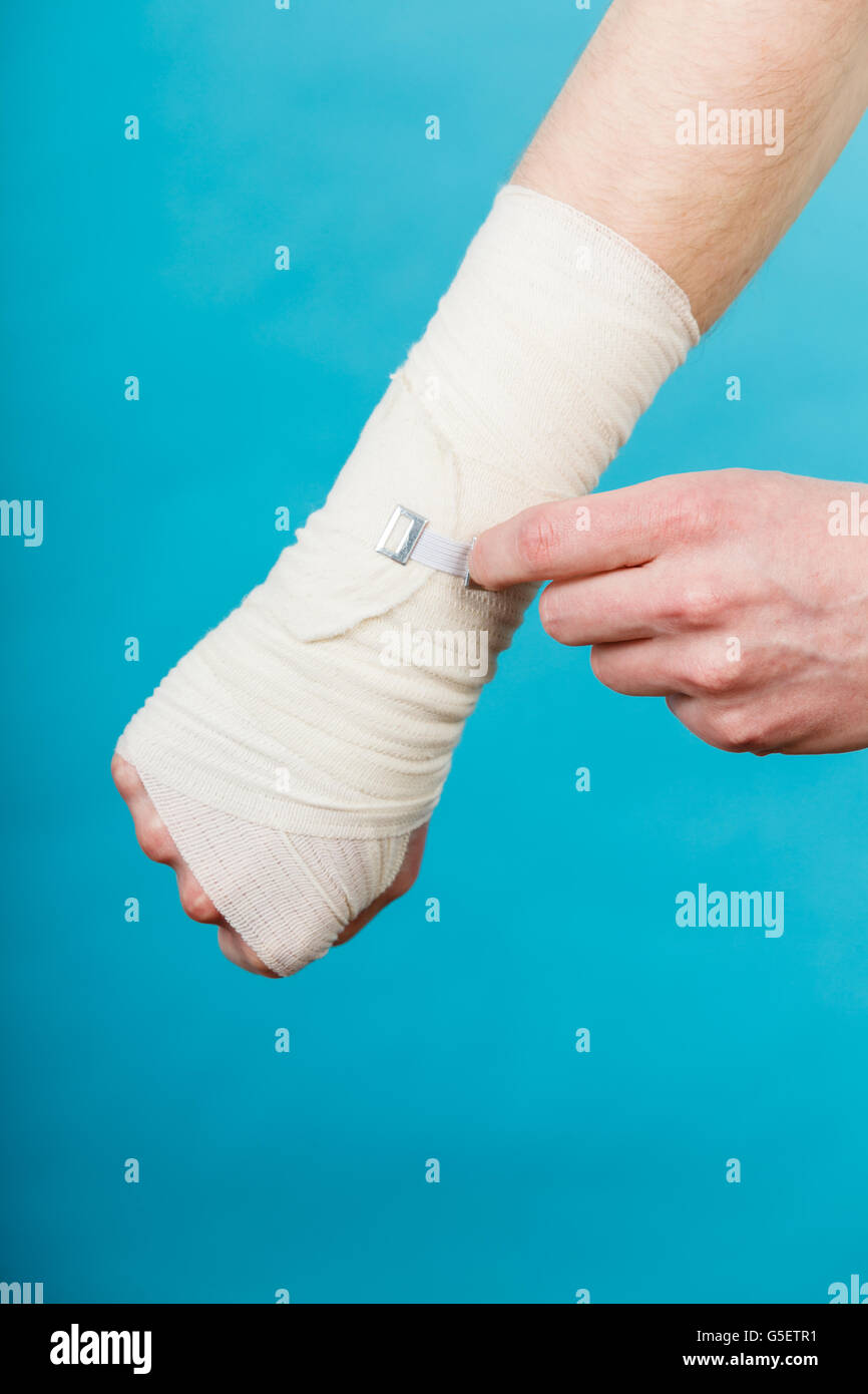 Fractures and dislocations concept. Male hand in white bandage. Helpful ...