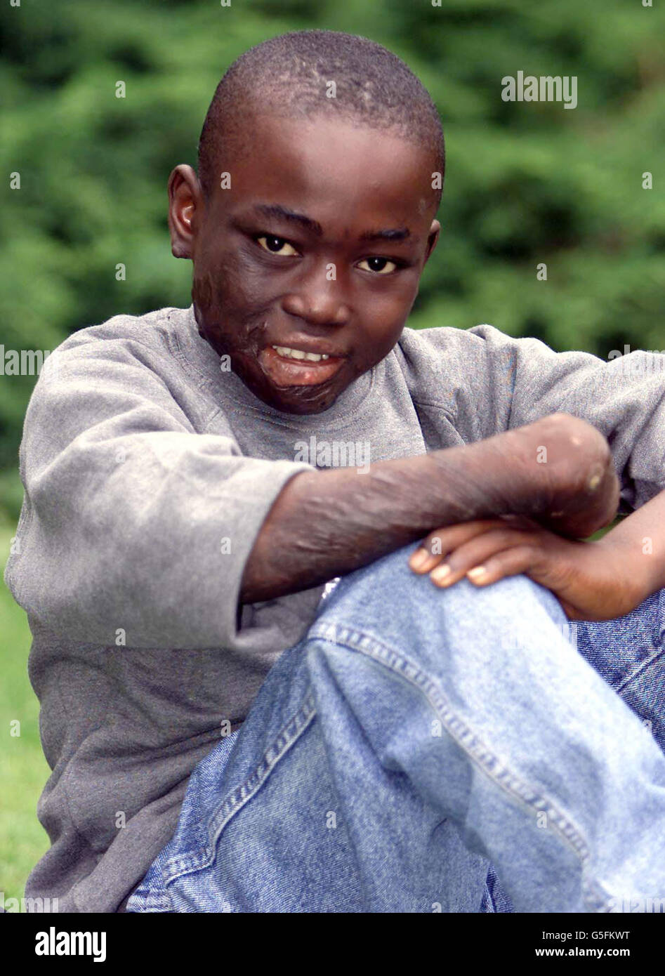 Issa Kamara, age 10, from a farming family in a village in the north of ...