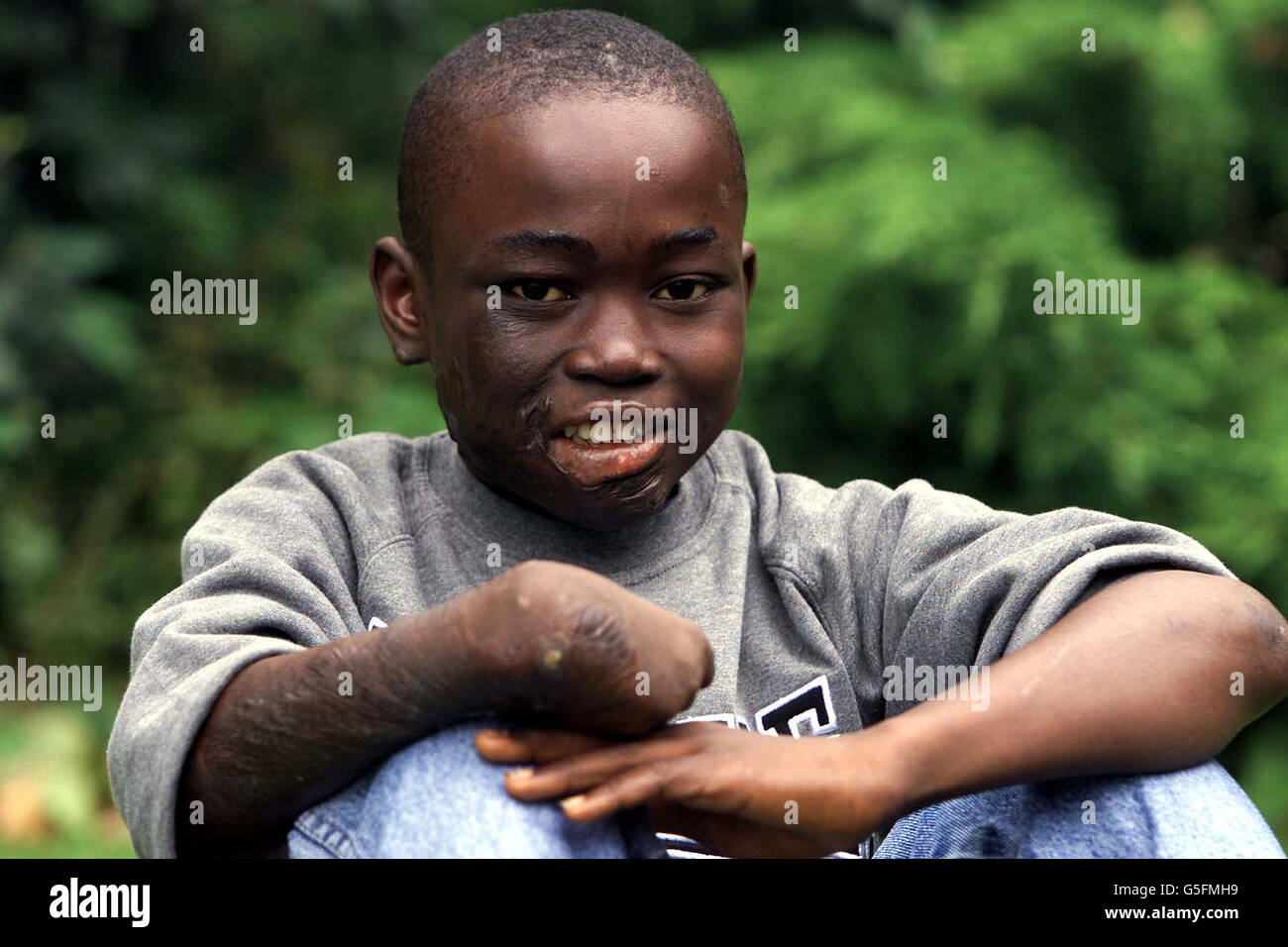 Issa Kamara Surgery Stock Photo - Alamy