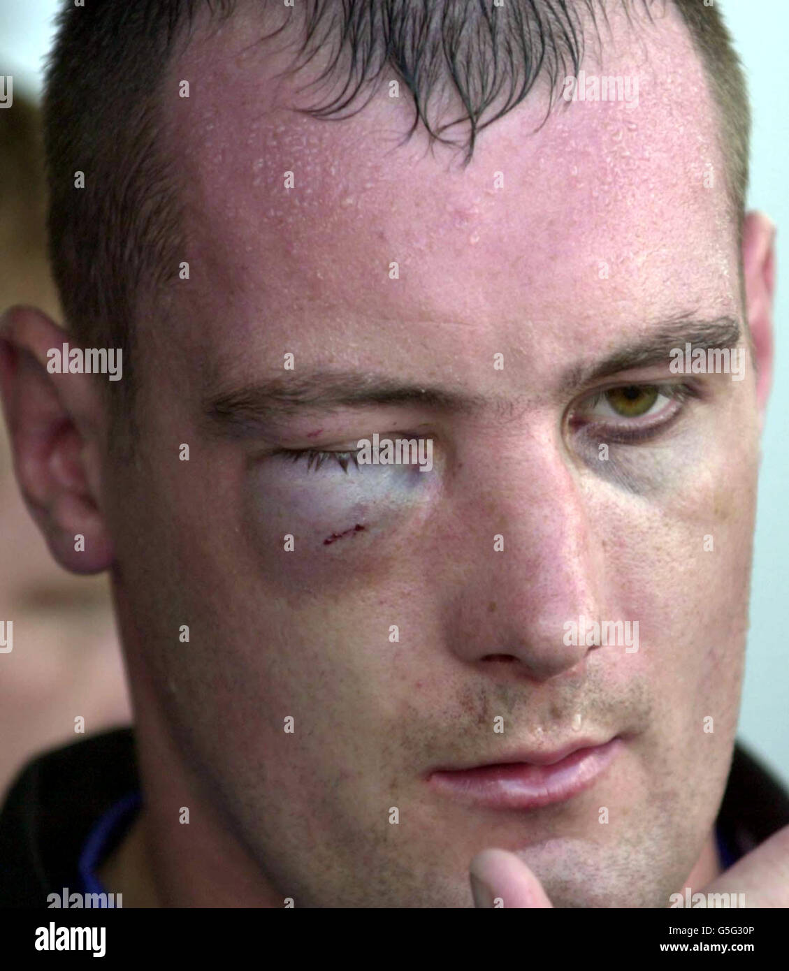 Eye Black In Rugby at Jai Reading blog