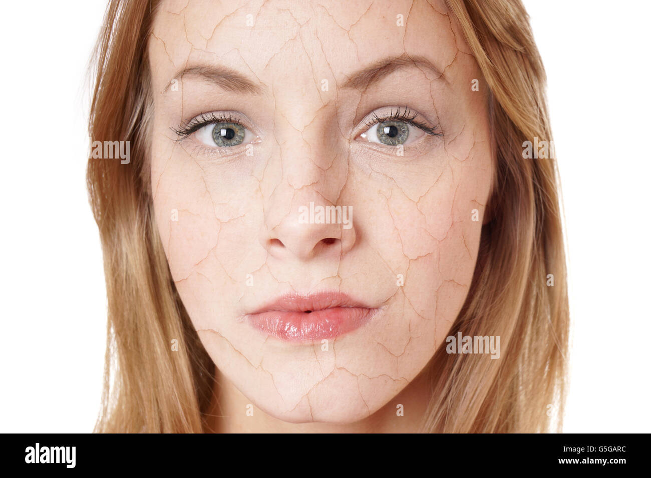 Dry skin problem hi-res stock photography and images - Alamy