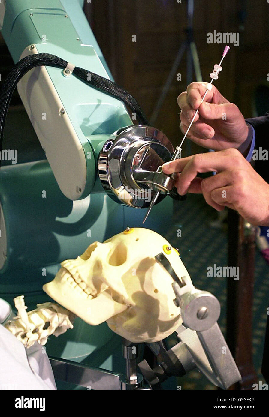 A biopsy probe being inserted into a model skull by a robot capable of ...