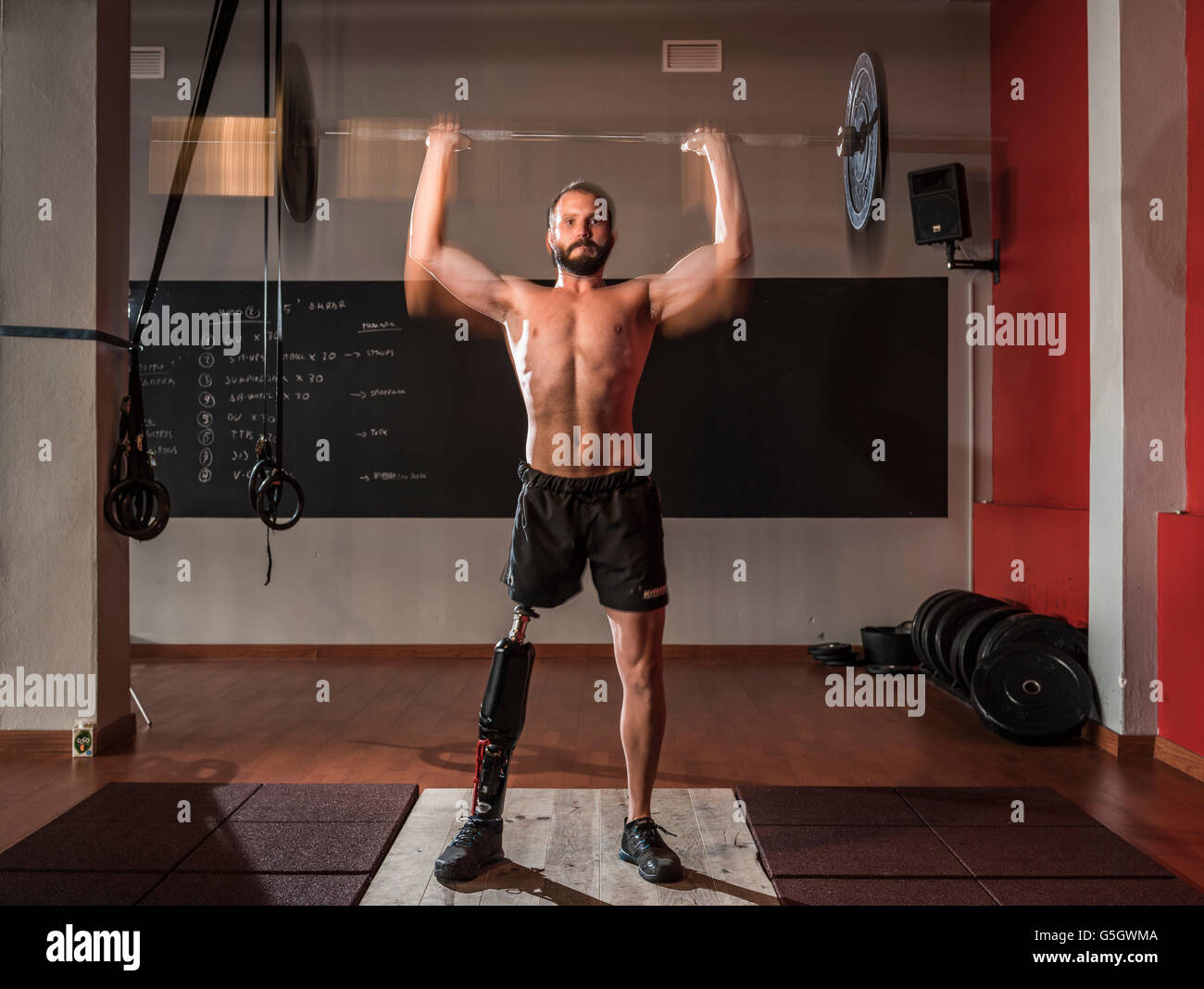 Prosthetic limb training hi-res stock photography and images - Alamy