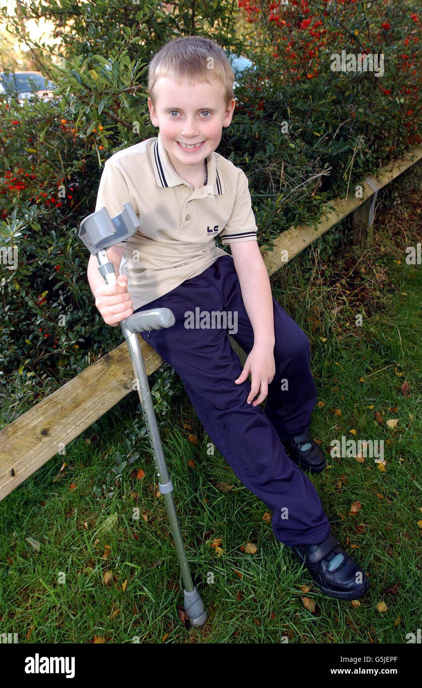 Maimed leg hi-res stock photography and images - Alamy