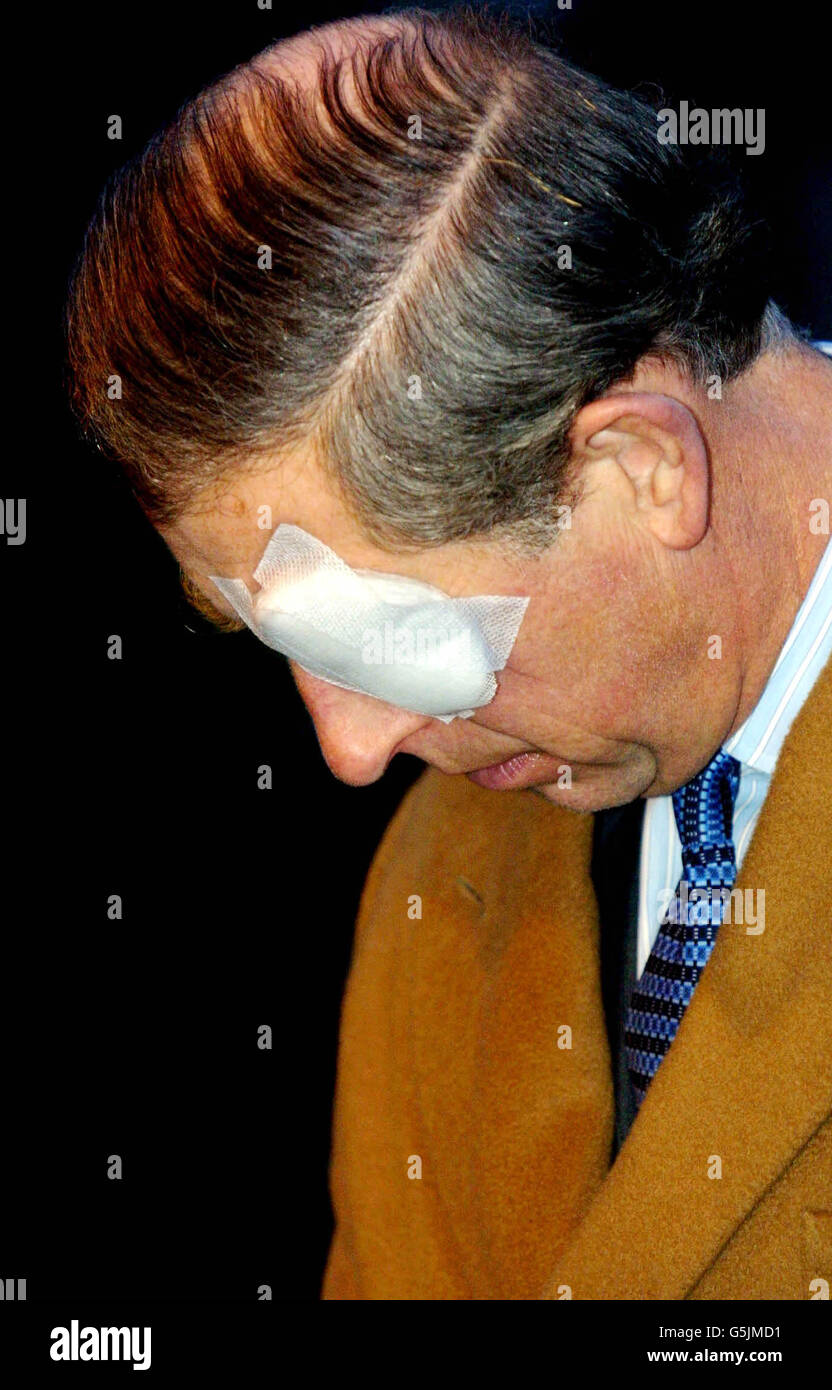 Prince Charles Eye Patch Stock Photo - Alamy