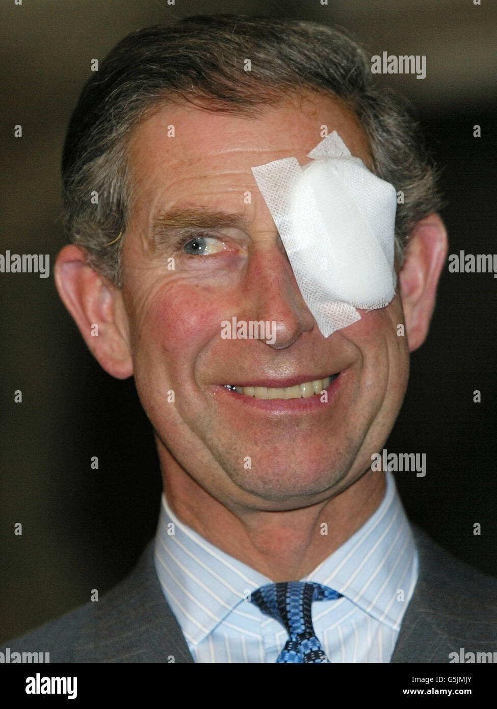 The prince wales wearing dressing over injured left eye hi-res stock ...