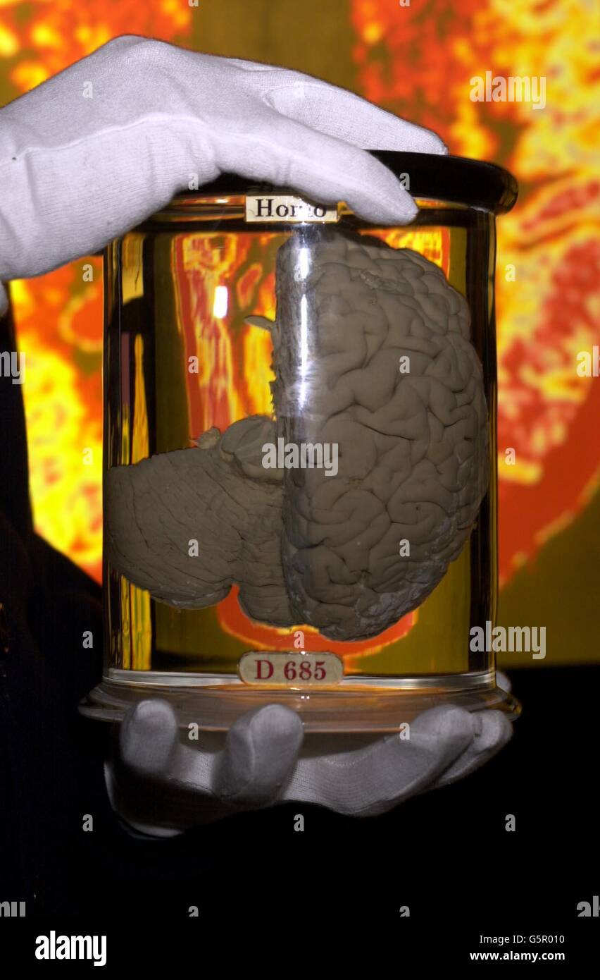 Charles Babbage Brain