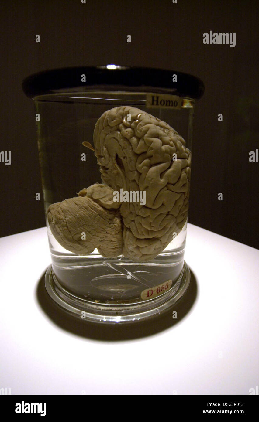 Charles Babbage Brain